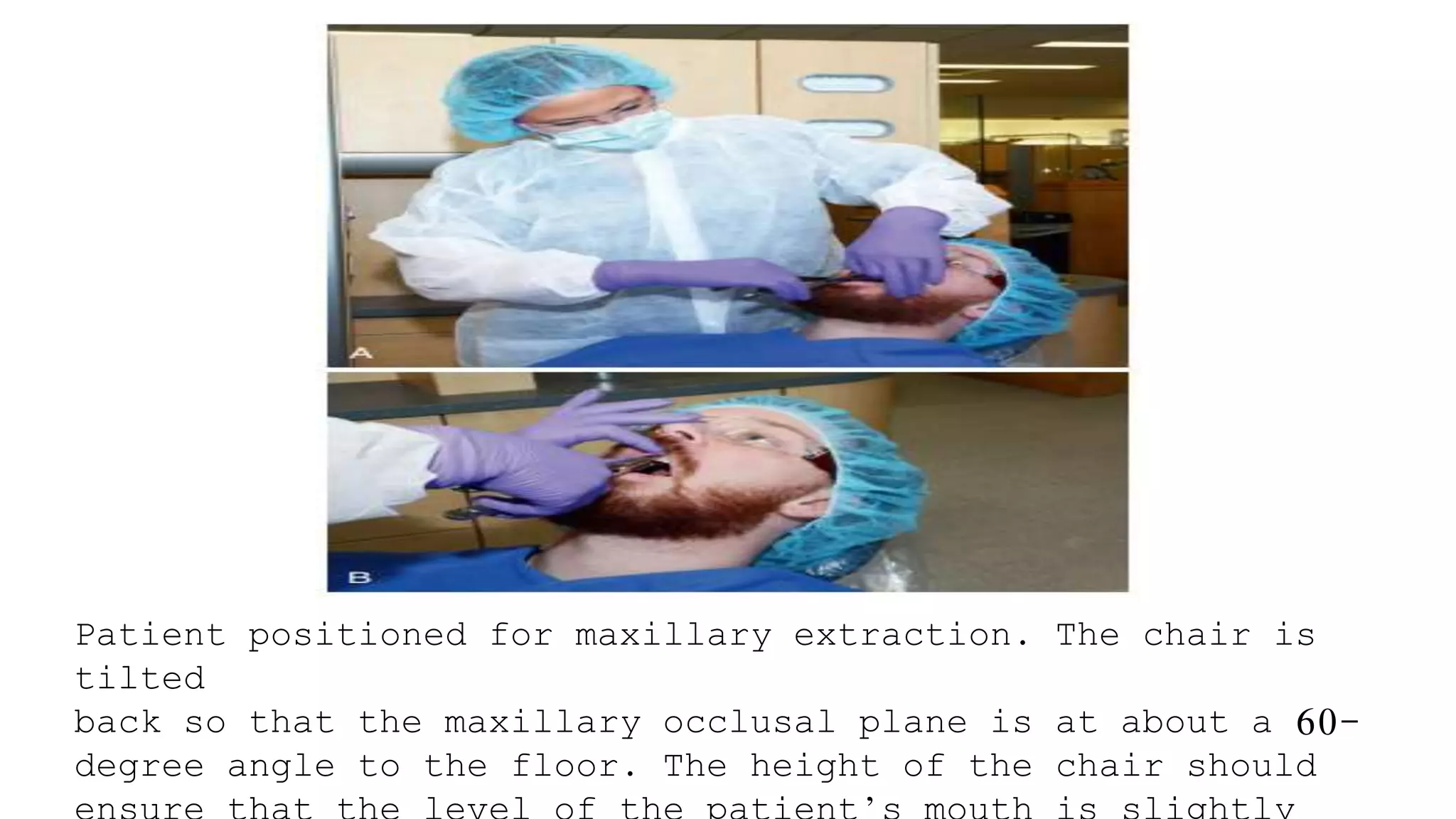 Routine Exodontia - simple extraction | PPT