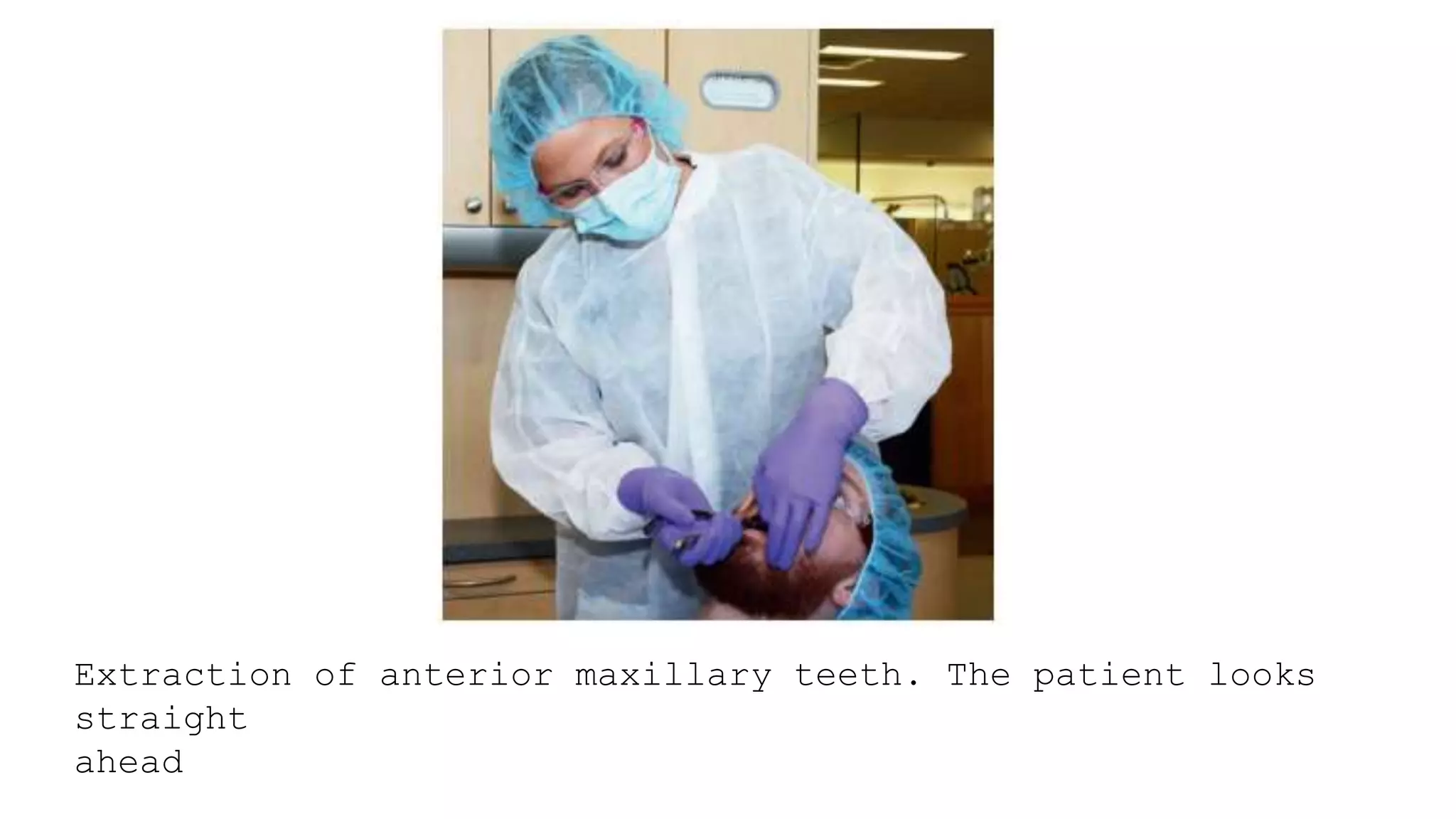 Routine Exodontia - simple extraction | PPT