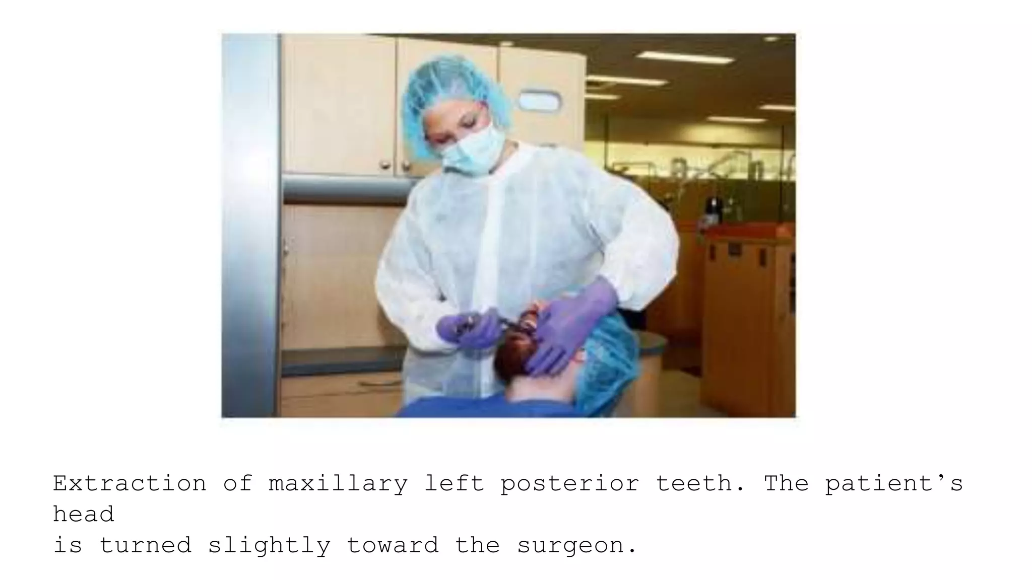 Routine Exodontia - simple extraction | PPT