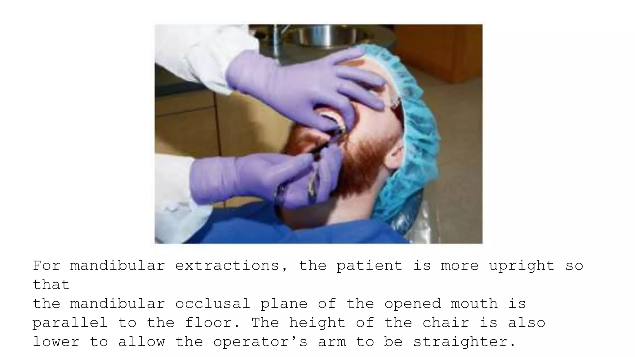 Routine Exodontia - simple extraction | PPT