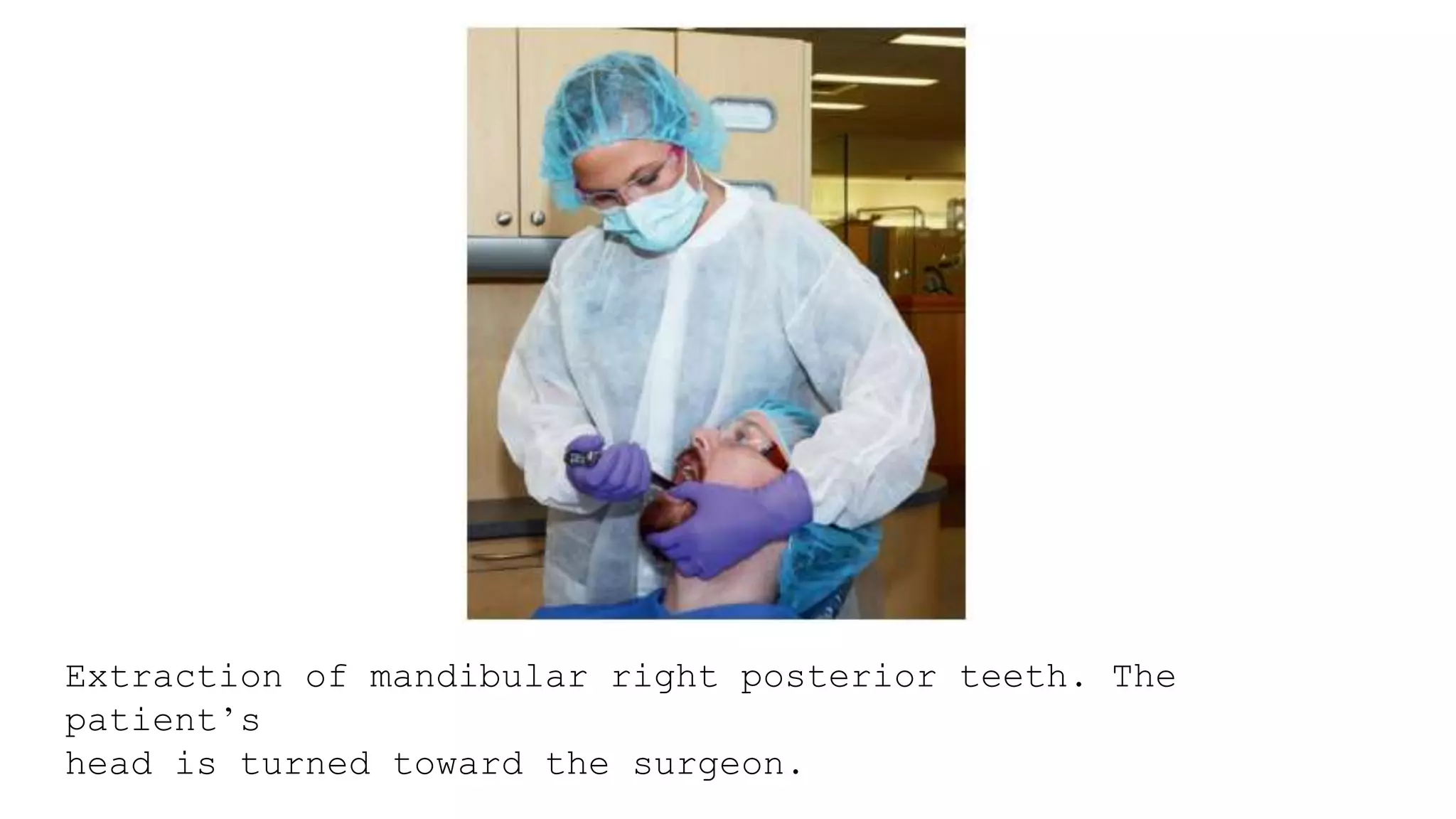 Routine Exodontia - simple extraction | PPT