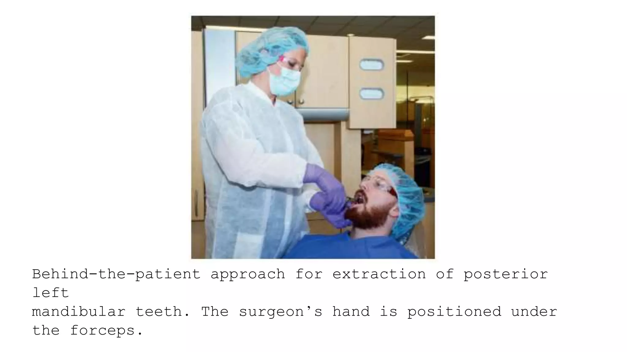 Routine Exodontia - simple extraction | PPT