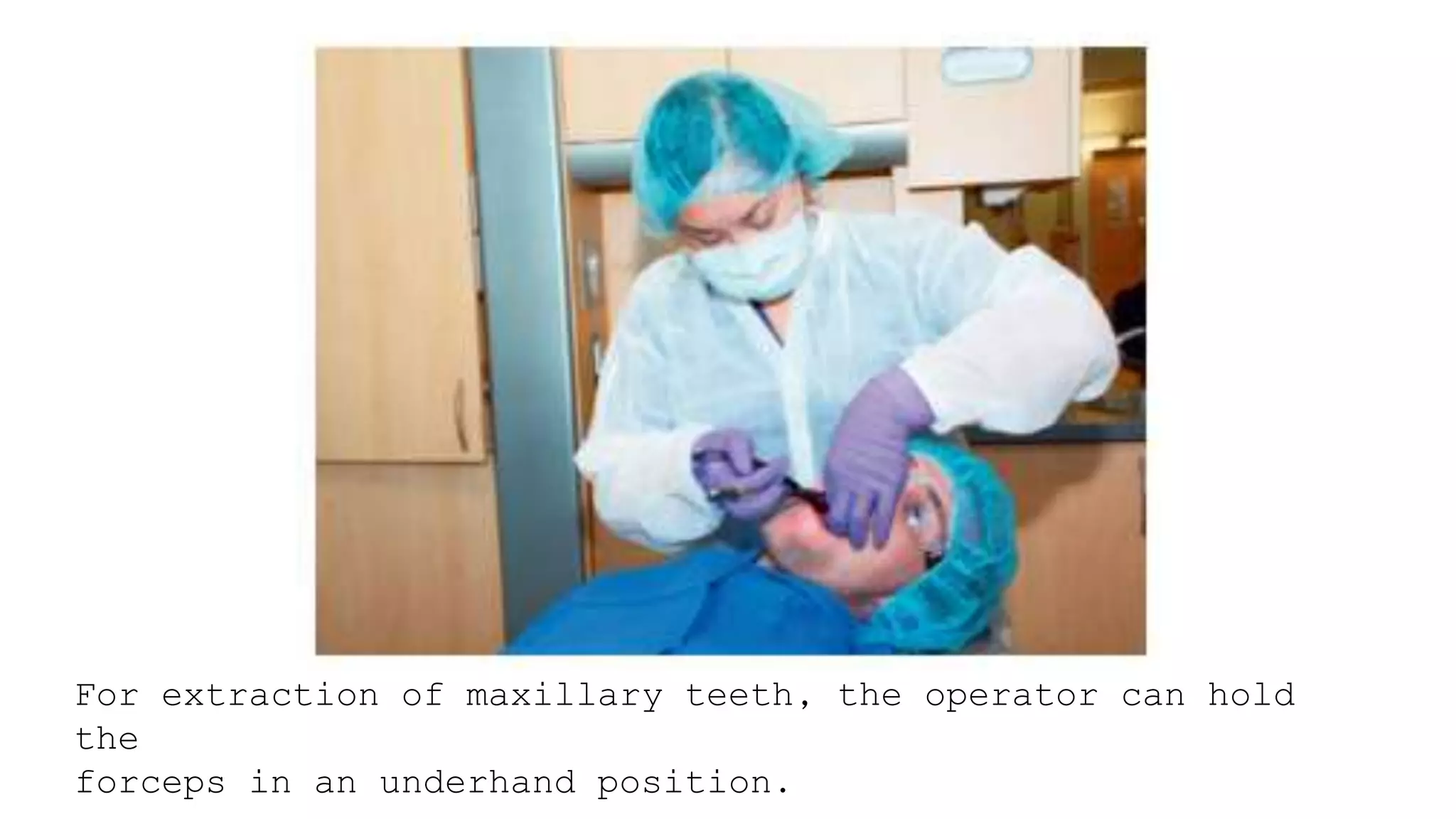 Routine Exodontia - simple extraction | PPT