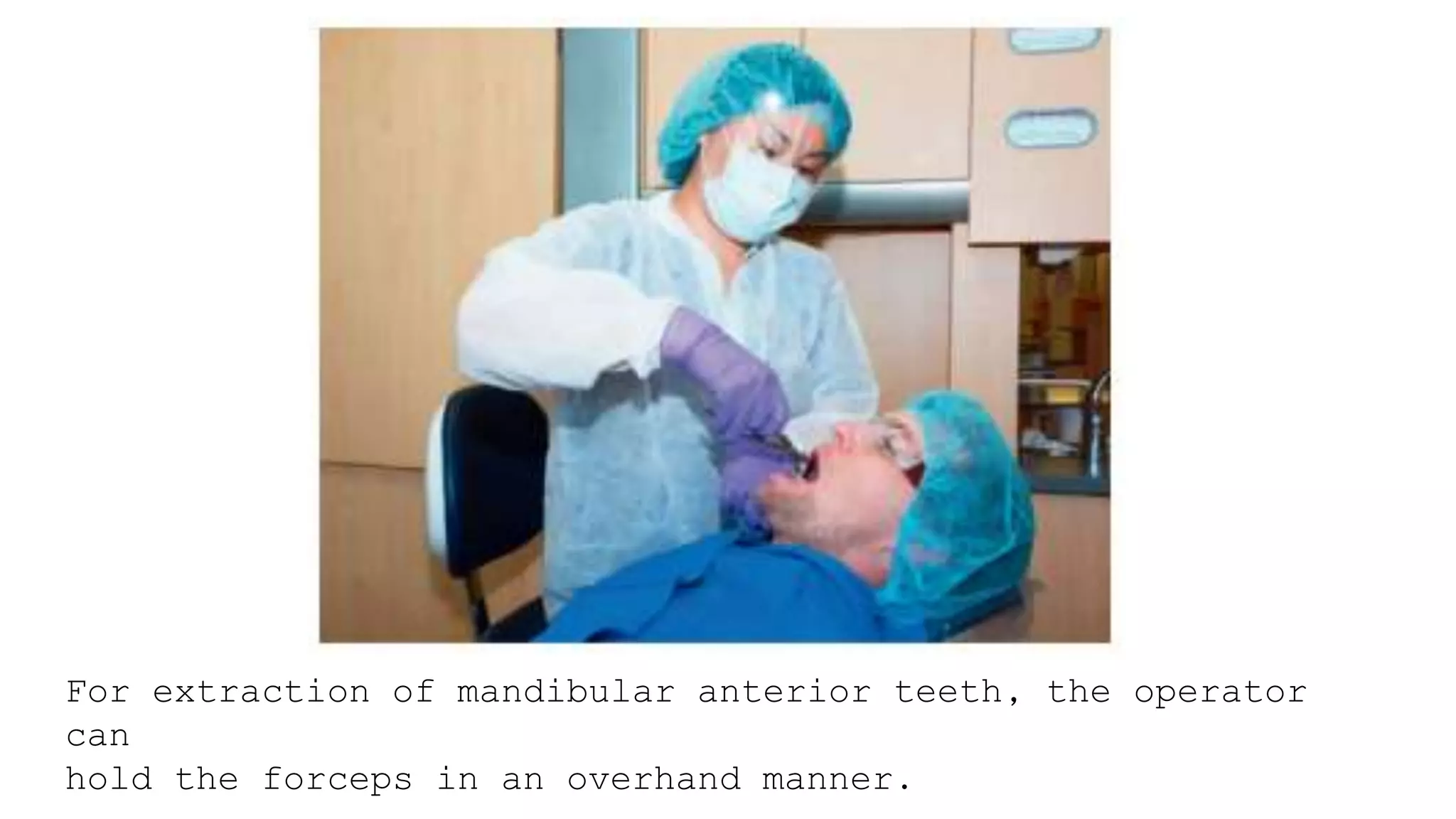 Routine Exodontia - simple extraction | PPT