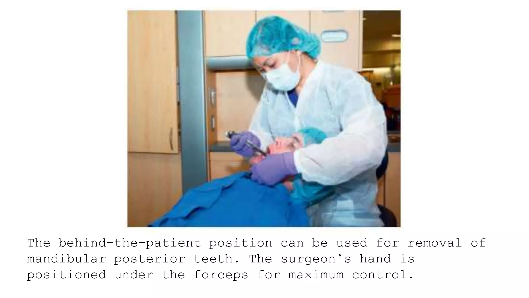 Routine Exodontia - simple extraction | PPT