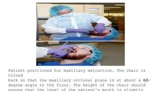 Routine Exodontia - simple extraction | PPTX