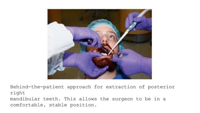 Routine Exodontia - simple extraction | PPT