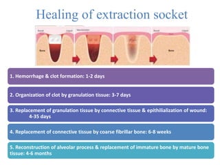 extraction teeth, Indication and contraindications 1.pdf