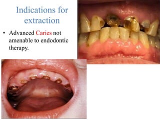 extraction teeth, Indication and contraindications 1.pdf