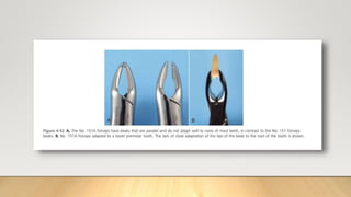 Extraction foreceps | PPTX | Dental Health | Diseases and Conditions