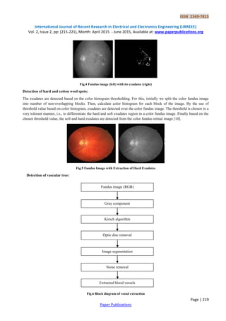 Extraction of Features from Fundus Images for Diabetes Detection | PDF ...