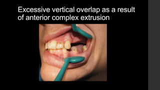 Extraction of maxillary anterior dentition, alveolectomy, gingivectomy ...
