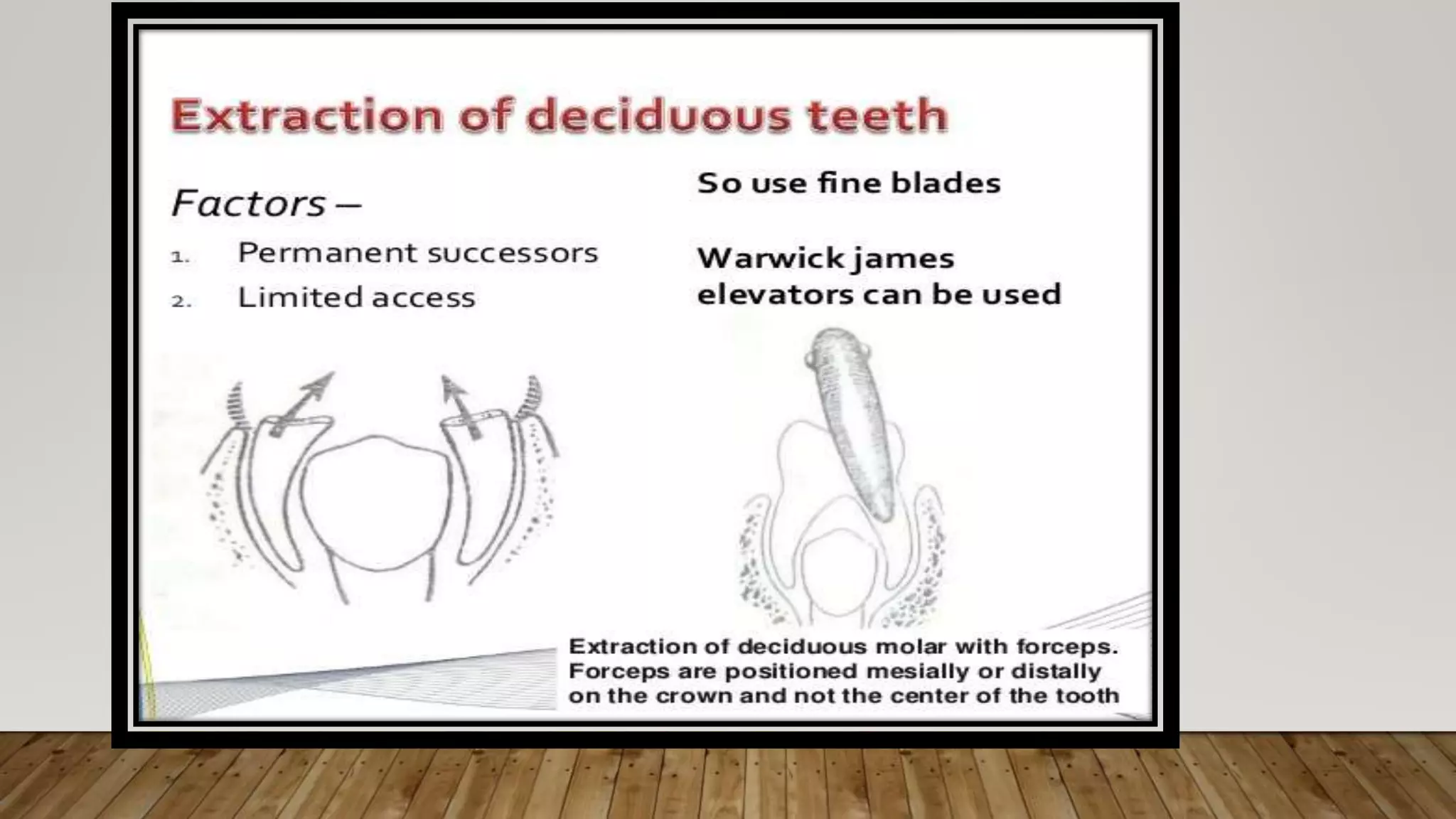 Extraction of primary teeth along with permanent teeth | PPTX