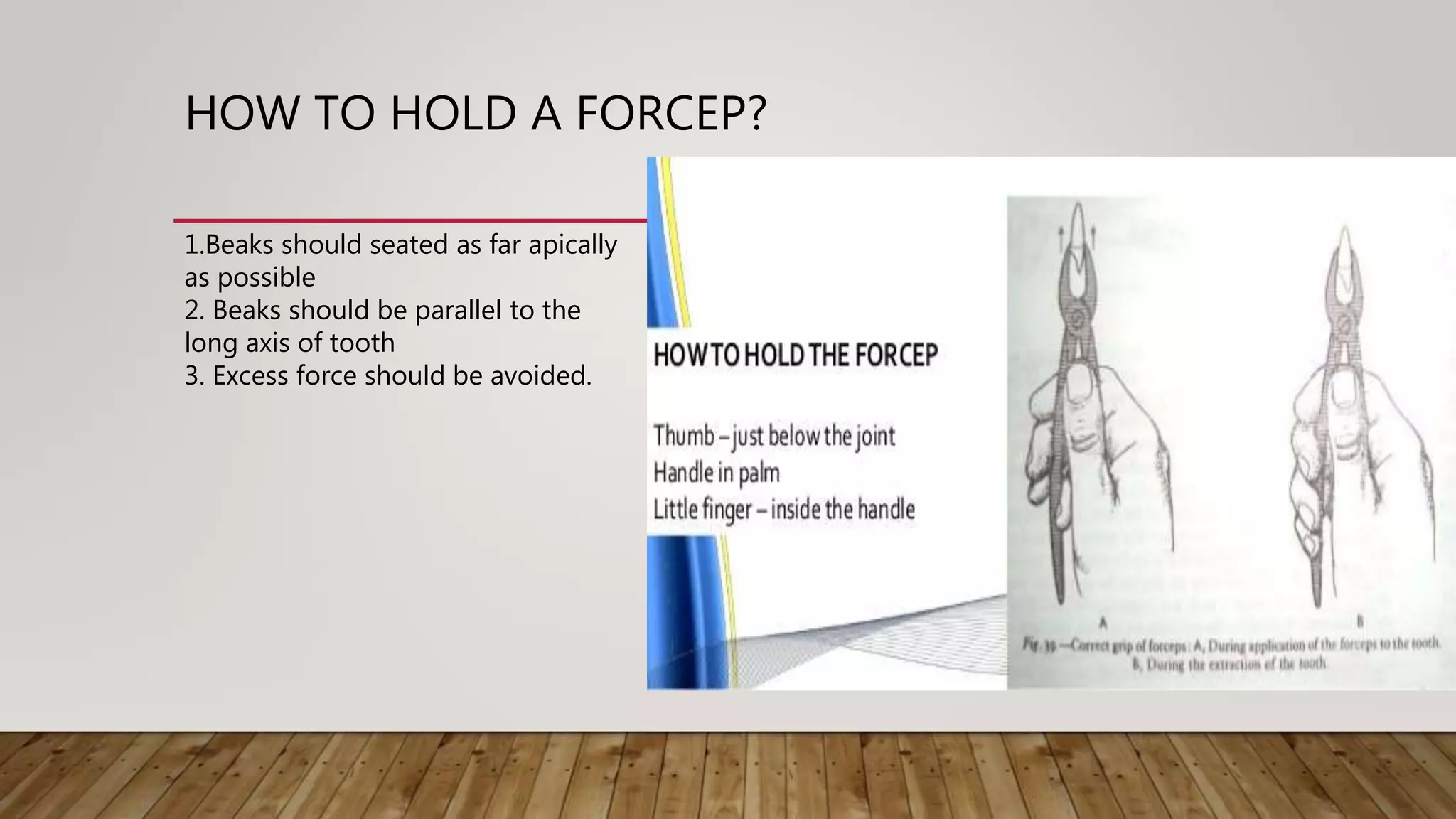 Extraction of primary teeth along with permanent teeth | PPTX