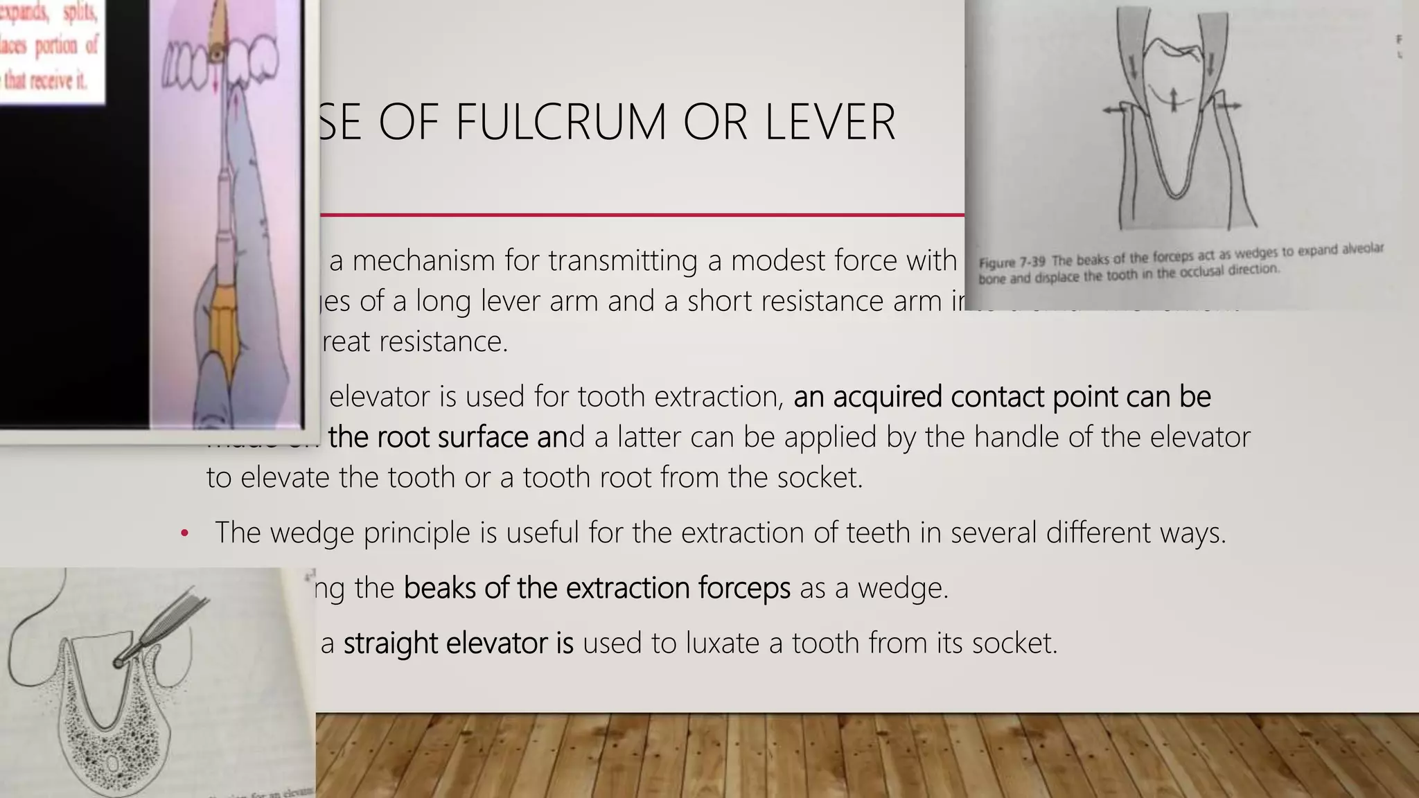 Extraction of primary teeth along with permanent teeth | PPTX
