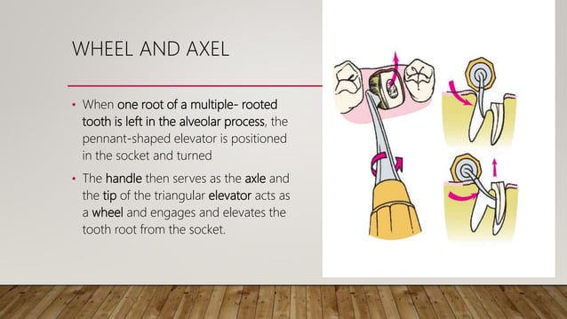Extraction of primary teeth along with permanent teeth | PPTX
