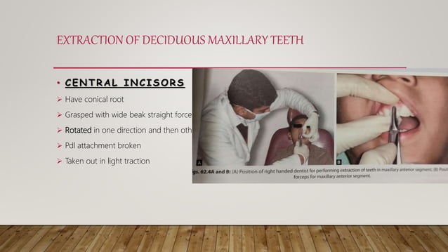Extraction of primary teeth along with permanent teeth | PPTX