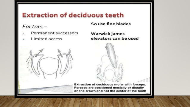 Extraction of primary teeth along with permanent teeth | PPTX