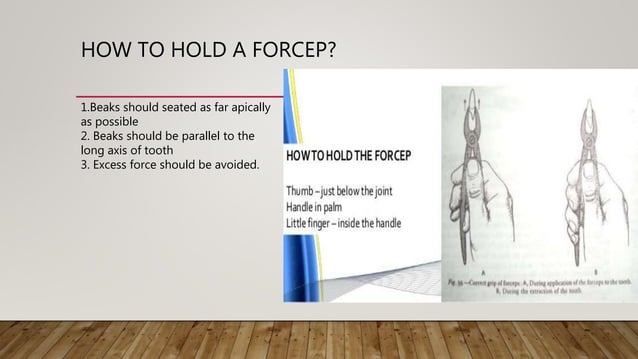 Extraction of primary teeth along with permanent teeth | PPTX