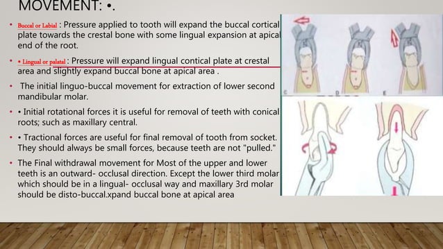 Extraction of primary teeth along with permanent teeth | PPTX