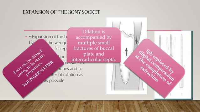 Extraction of primary teeth along with permanent teeth | PPTX