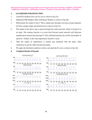 Extraction of qrs complexes using automated bayesian regularization neural network | PDF