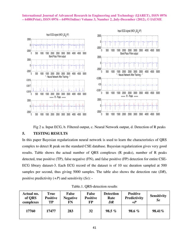 Extraction of qrs complexes using automated bayesian regularization neural network | PDF