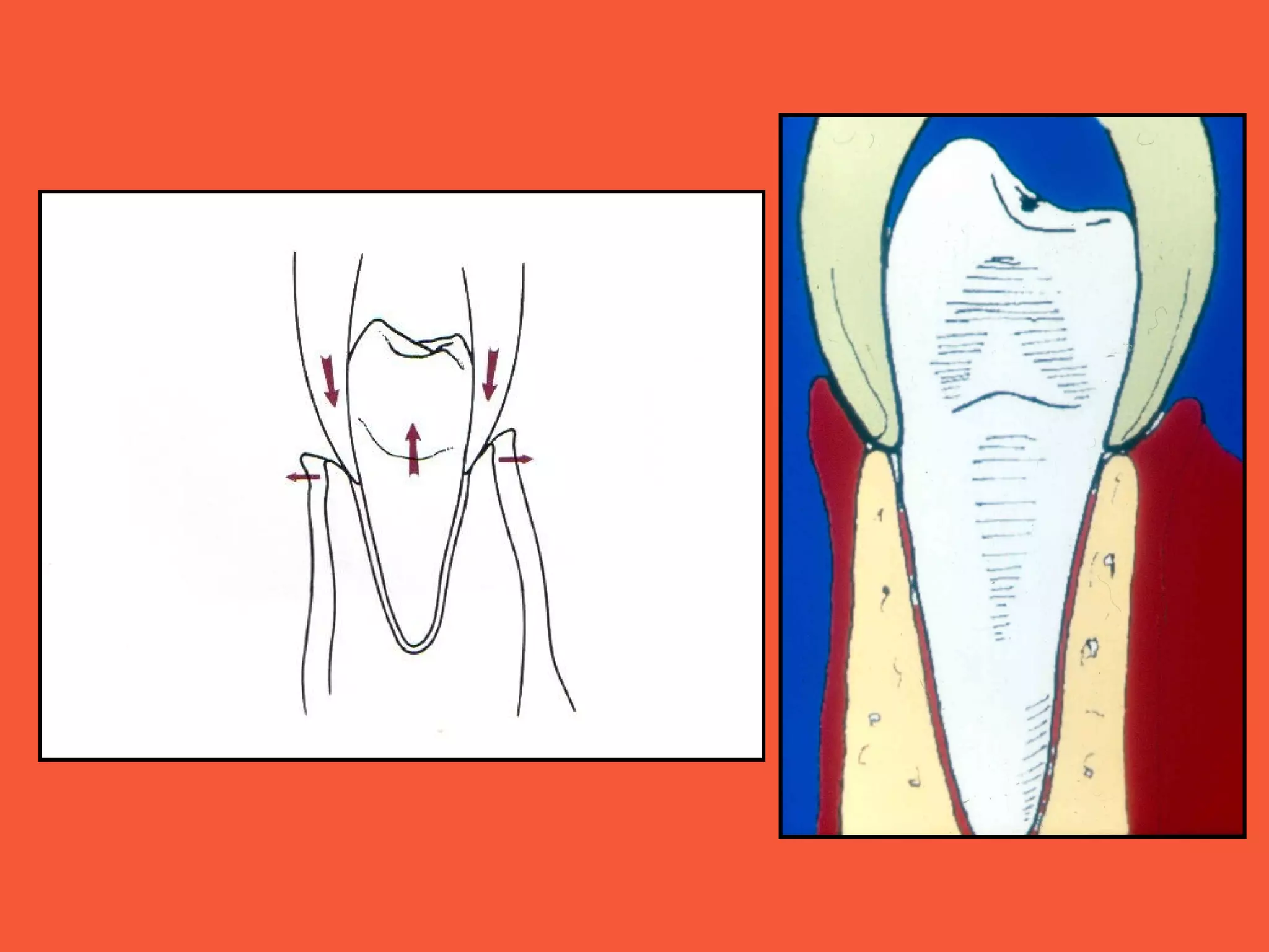 Extraction of teeth | PPT