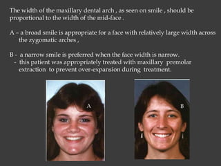 A differential diagnostic decision for extraction and non-extraction | PPT