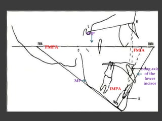 Extraction or non extraction | PPTX