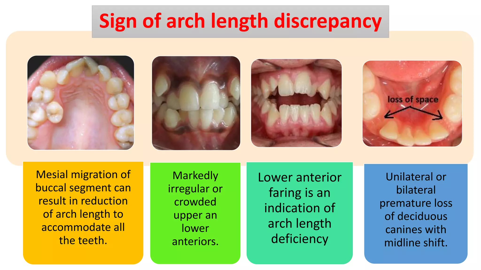 Extractions in orthodontics | PPTX