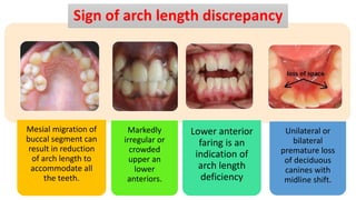 Extractions in orthodontics | PPTX