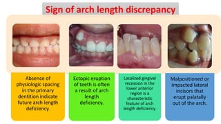 Extractions in orthodontics | PPTX