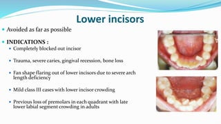 extractions in the field of orthodontics | PPTX