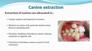 extractions in the field of orthodontics | PPTX