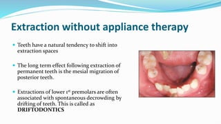extractions in the field of orthodontics | PPTX