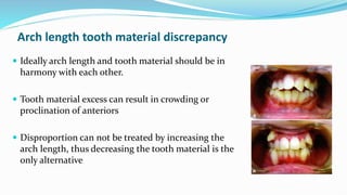 extractions in the field of orthodontics | PPTX