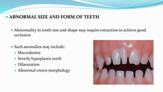 extractions in the field of orthodontics | PPTX