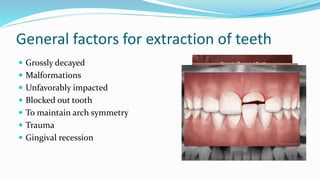 extractions in the field of orthodontics | PPTX
