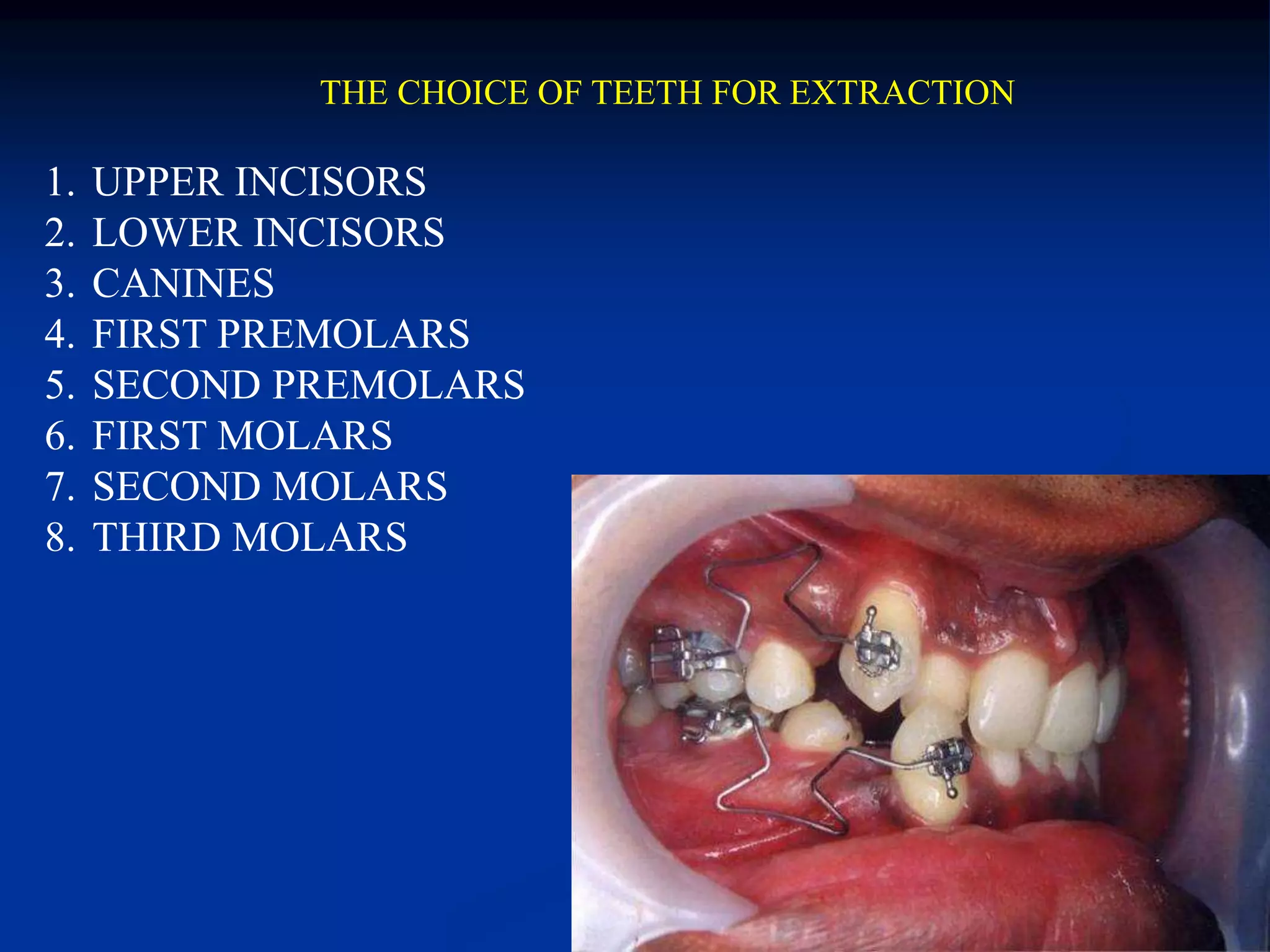 Extractions in orthodontics | PPT