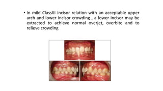 Extractions in orthodontics.pptx