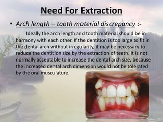 Extractionsinorthodontics ug-130701154008-phpapp02 | PPT