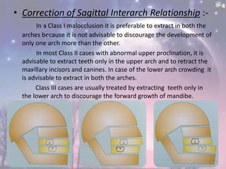 Extractionsinorthodontics ug-130701154008-phpapp02 | PPT