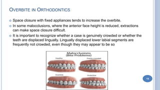Extractions in Orthodontics Journal Club Presentation | PPTX