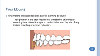 Extractions in Orthodontics Journal Club Presentation | PPTX