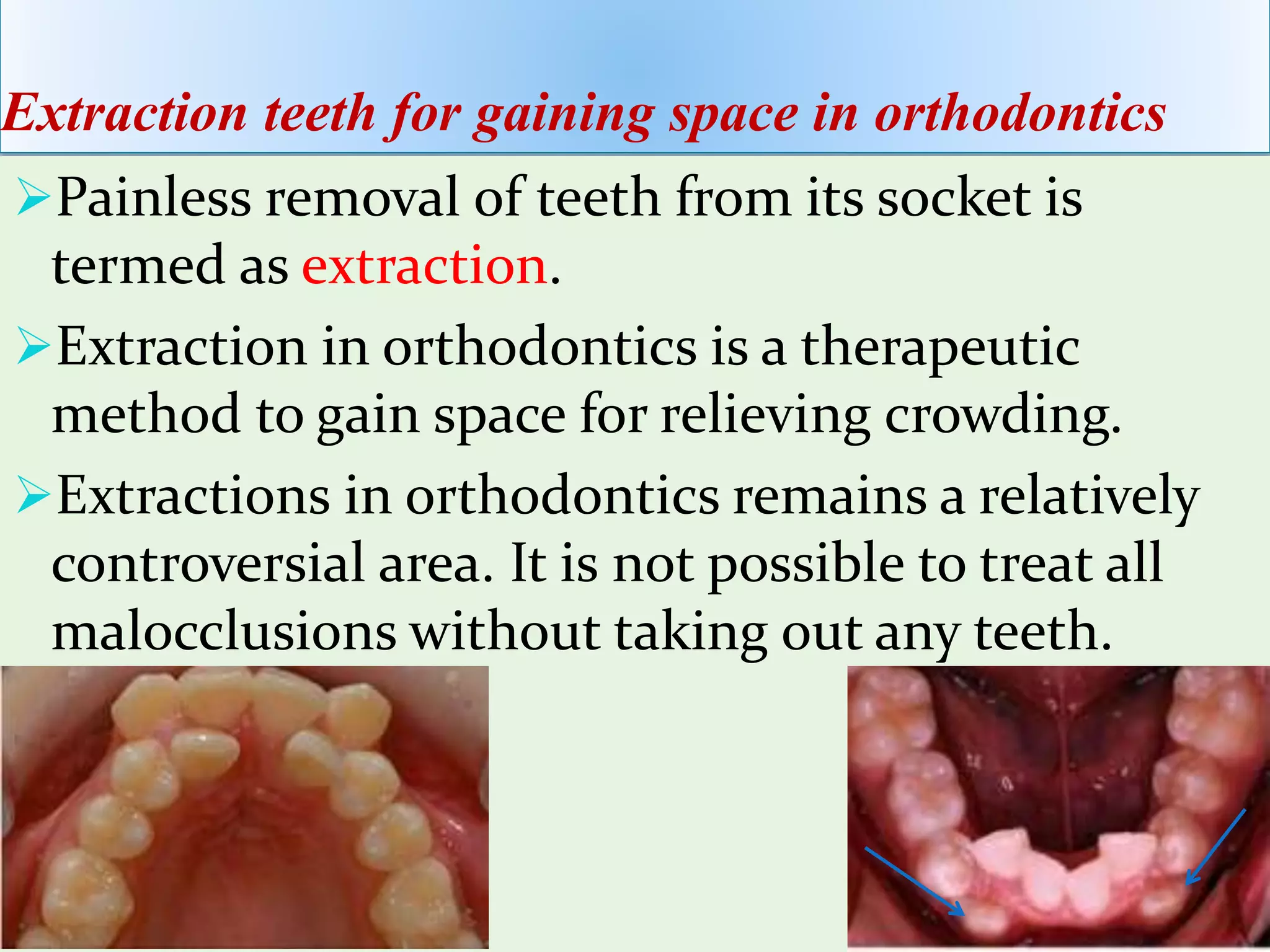 Extraction teeth for gaining space in orthodontics | PPTX