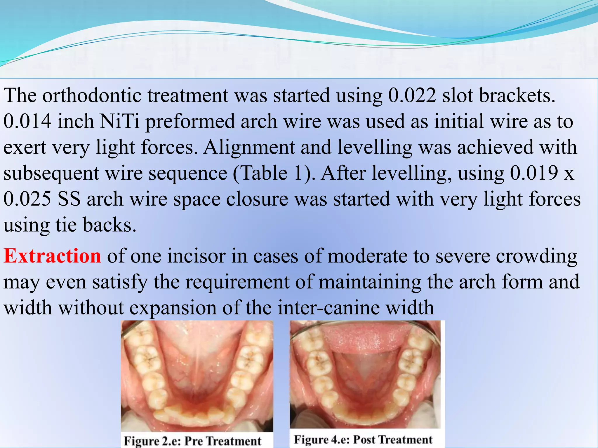 Extraction teeth for gaining space in orthodontics | PPT