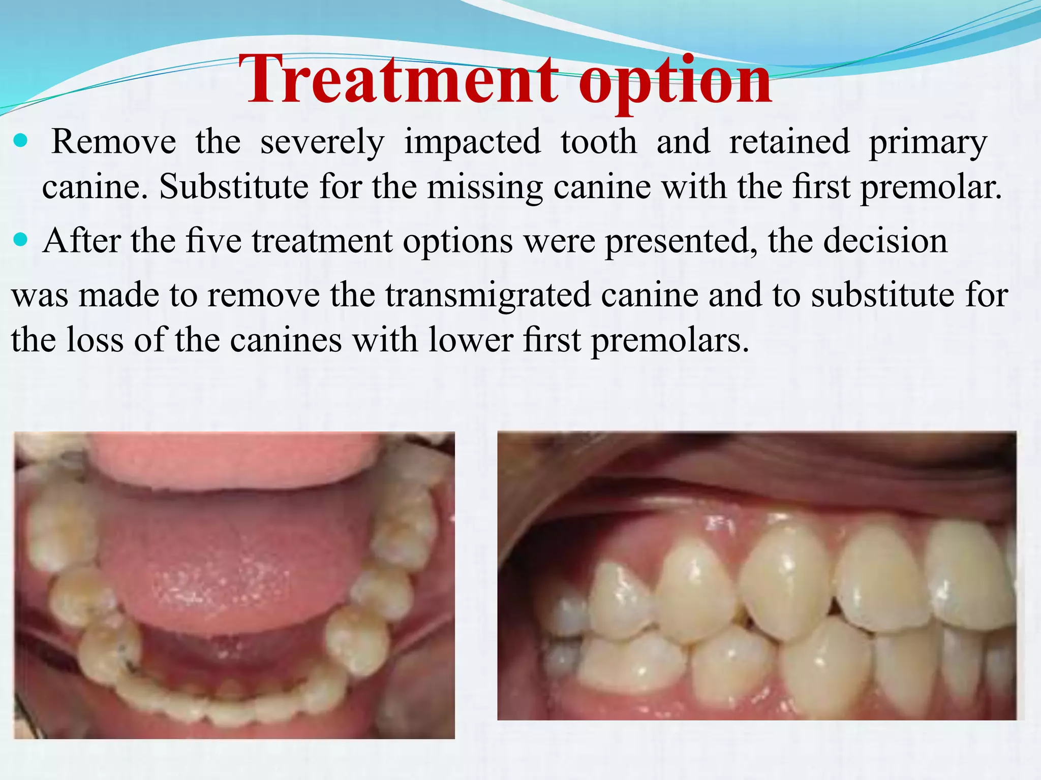 Extraction teeth for gaining space in orthodontics | PPTX