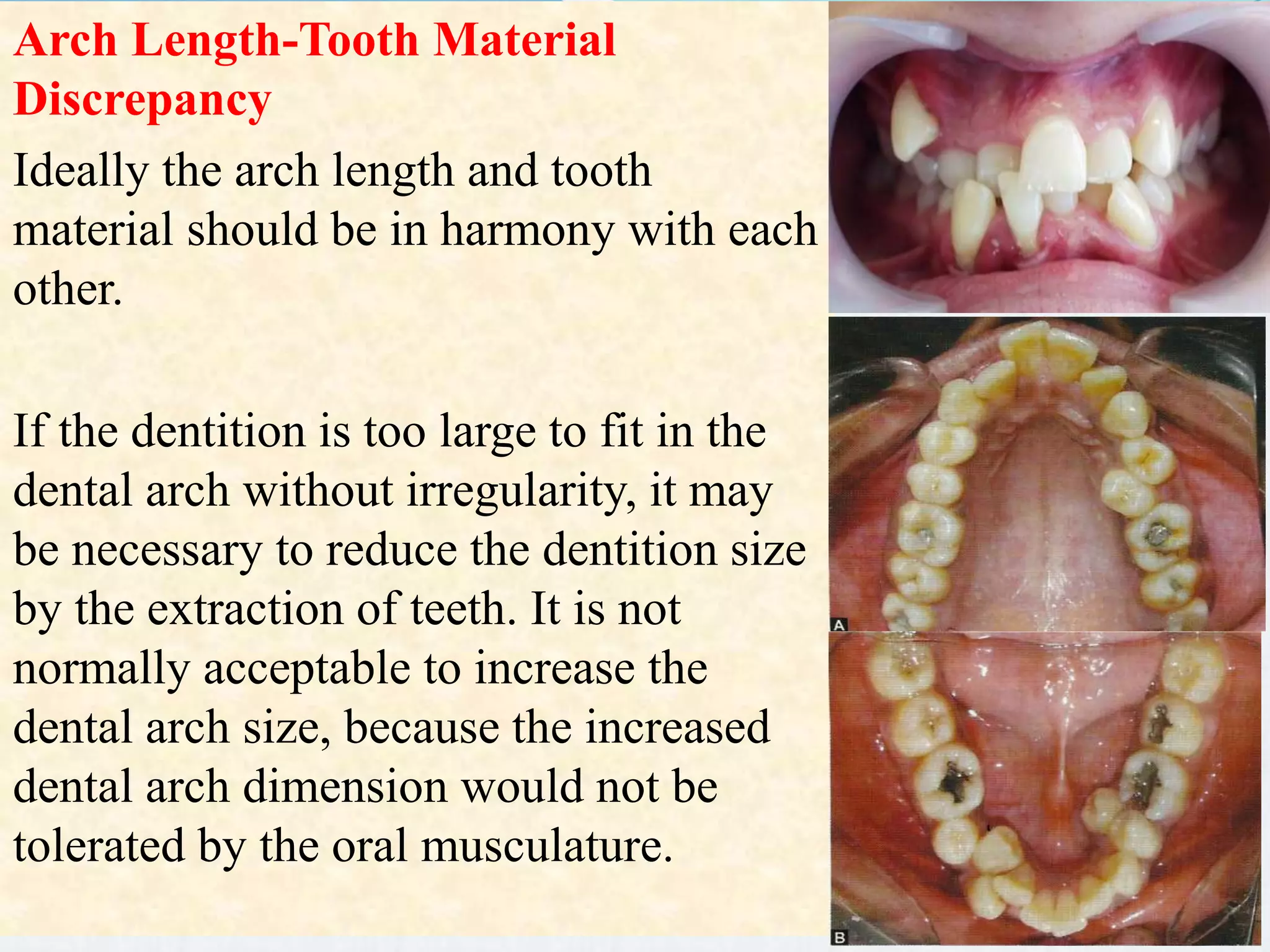 Extraction teeth for gaining space in orthodontics | PPTX