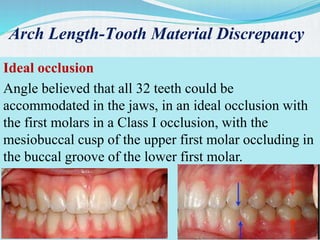 Extraction teeth for gaining space in orthodontics | PPTX